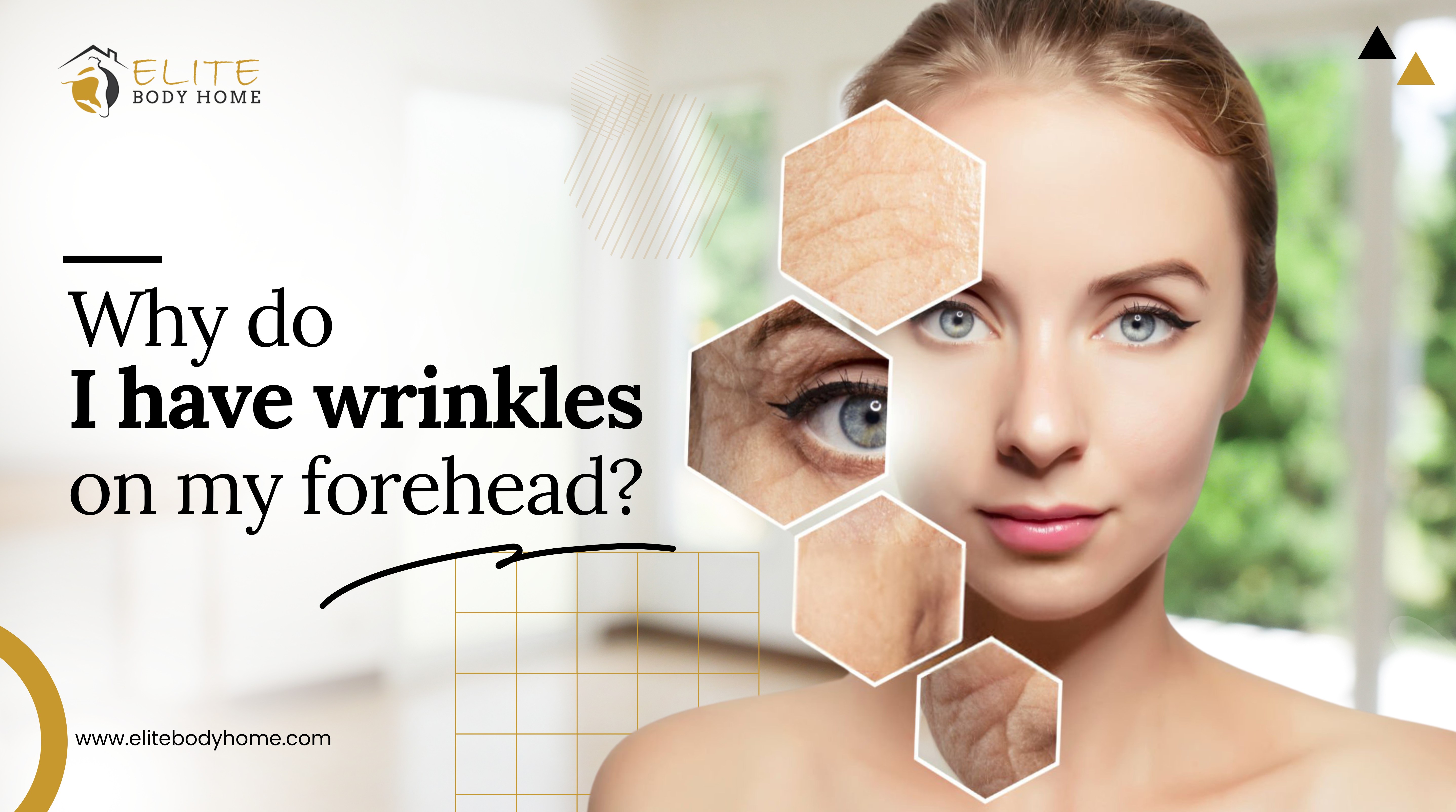 Forehead Wrinkles: Causes & Best Treatments in Dubai | Elite Body Home ...