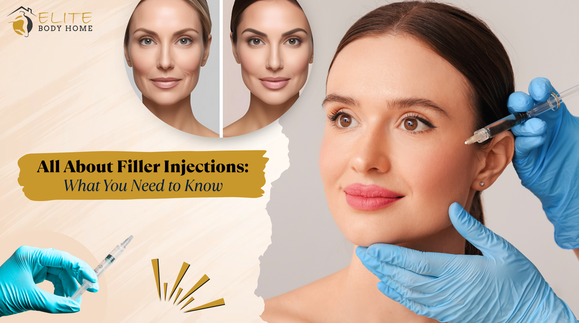 Filler Injections | EBH, Jumeirah 1, Dubai